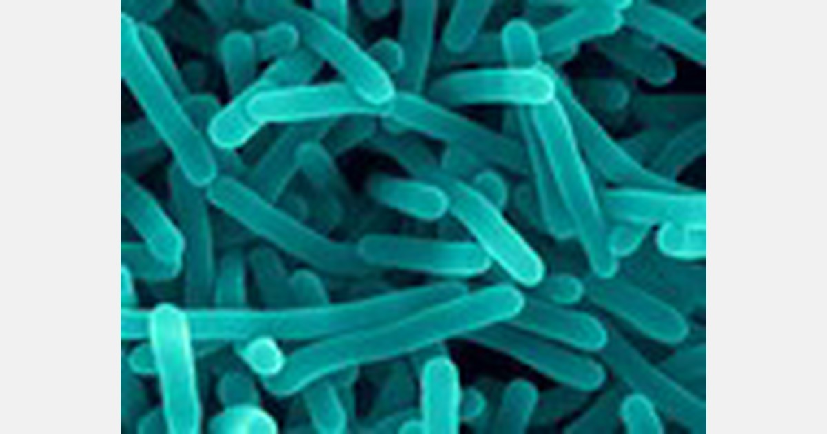 UMAS Project looks at surface changes & coatings to reduce biofilms