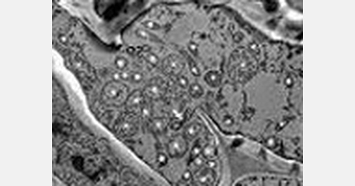 CRDF funds project to arrest HLB bacteria