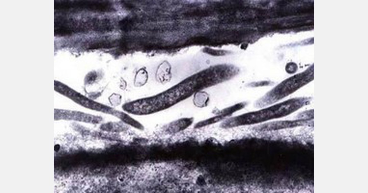 HLB bacterium discovered in Californian commercial citrus groves