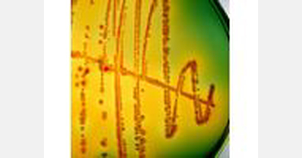 New research shows how pathogenic E. coli binds to fresh vegetables